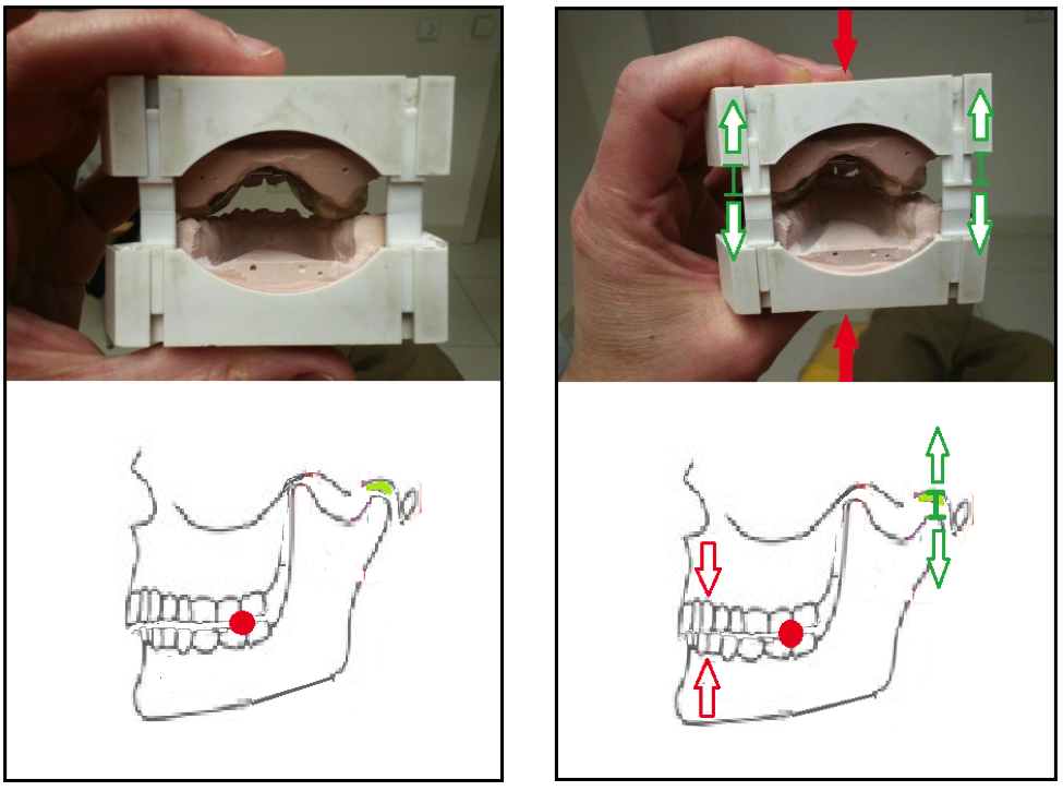 TMJ Not Improving With Night Guard TMJ Not Improving With Night Guard